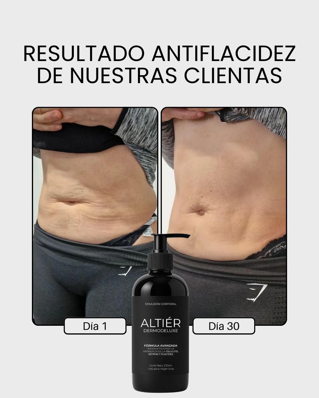 DERMODELUXE – EMULSIÓN CORPORAL DE LUJO - 230 ML – Altiér Beauty
